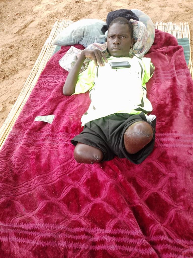 Crocodile attack victim recounts horror encounter - VicFallsLive